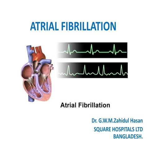 Aterial fibrillation acls | PPT