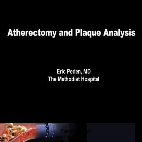 Atherectomy and Plaque Analysis, pumpsandpipesmdhc | PPT