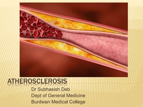 Atherosclerosis pathophysiology | PPT