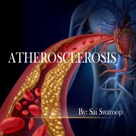 Atherosclerosis | PPT
