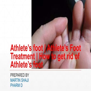 Athlets foot-treatment |management |symptoms| medical information | PPTX