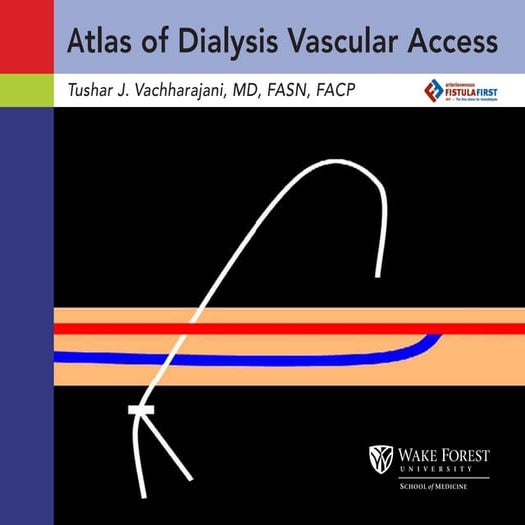 Dialysis Access Atlas | PDF