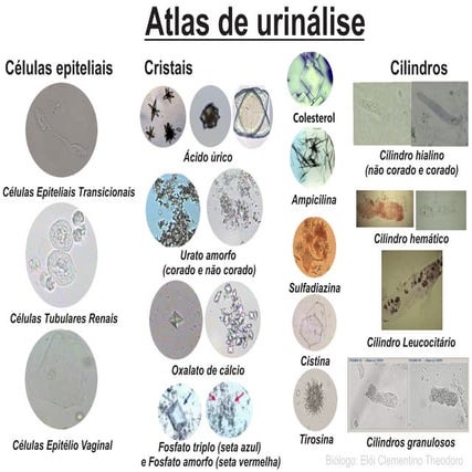 Atlas da urinálise | PDF