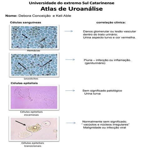 4. Exame Microscópico da Urina praticas | PPTX