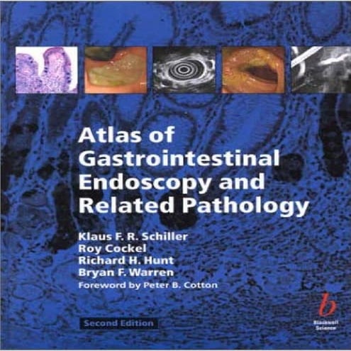 Atlas of gastrointestinal endoscopy and related pathology (blackwell ...