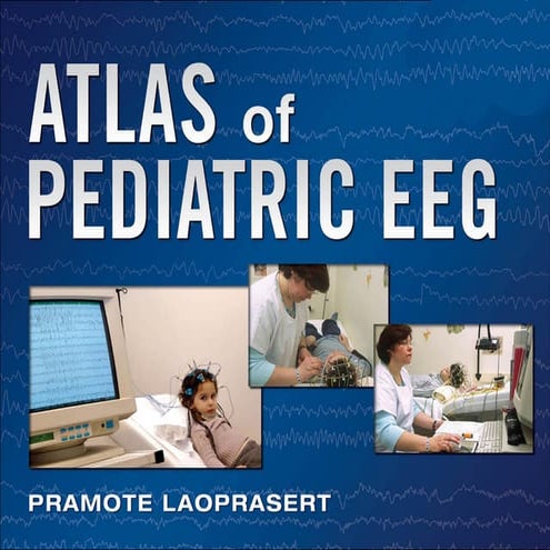 Atlas of Pediatric EEG.pdf