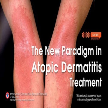 Atopic-Derm-CME_Slides.pptx
