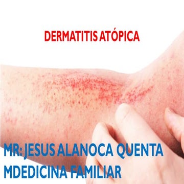 ATOPICA.pptxdermatologia piel atopia jjj | PPTX