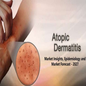 Atopic Dermatitis- Upcoming Novel therapies will boost the market | PPTX