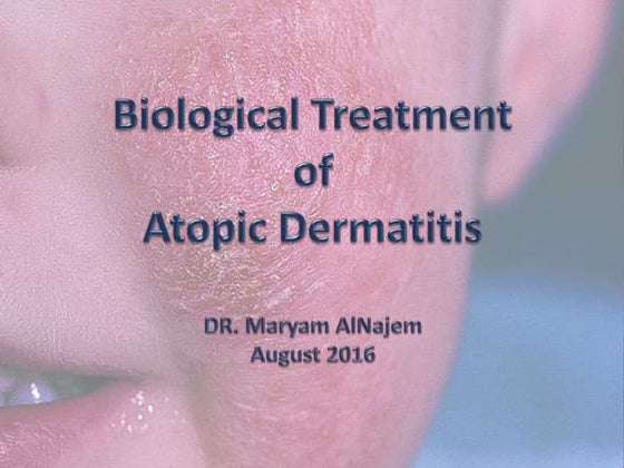pathogenesis dermatitis atopik.pdf