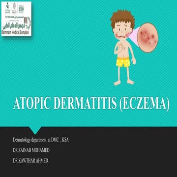 Atopic dermatitis | PPTX