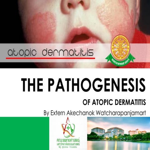 The pathogenesis of Atopic dermatitis | PDF