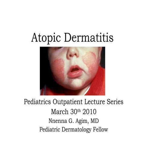nursing care for atopic dermatitis(pedi).ppt