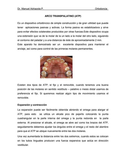 Arco transpalatino | PPT