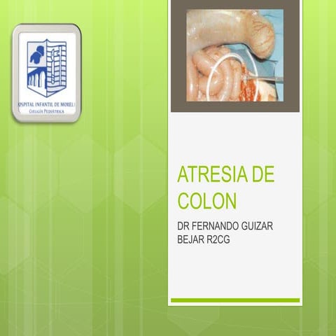 ATRESIA DE COLON.pptx