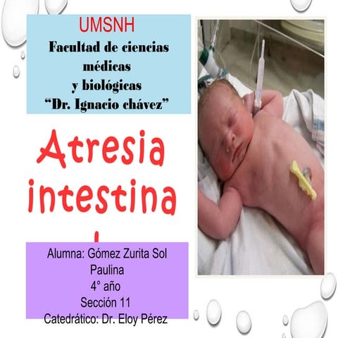 Atresia intestinal | ODP