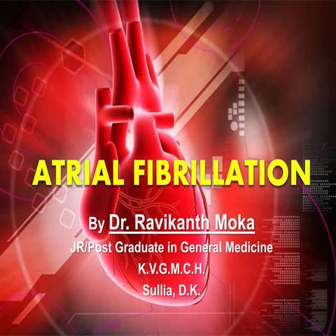 ATRIAL FIBRILLATION 2016 | PPTX