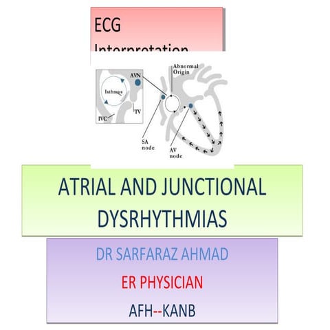 ECG Atrial and Junctional rhythms Dr Sarfaraz | PPT