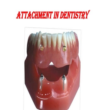 ATTACHMENTUSED IN COMPLETE DENTURE IN DENTISTRY.pptx