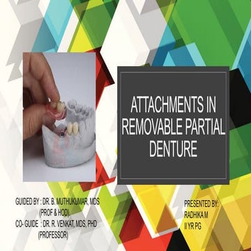 ATTACHMENTS IN RPD.pptx MFS dentistry …// | PPTX