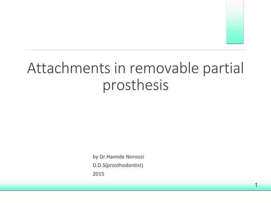 Attachments & their use in rpd fabrication | PPT