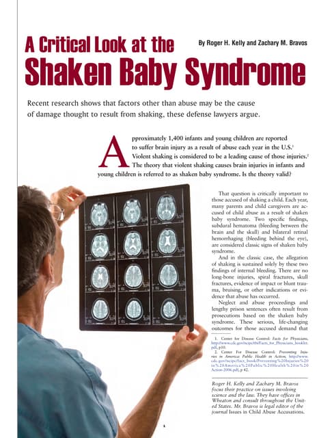 Baby shake syndrome | PPT