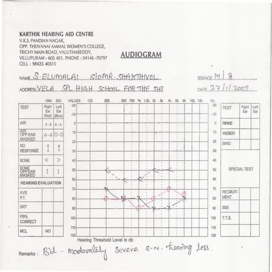 Audiogram 7 children | PDF