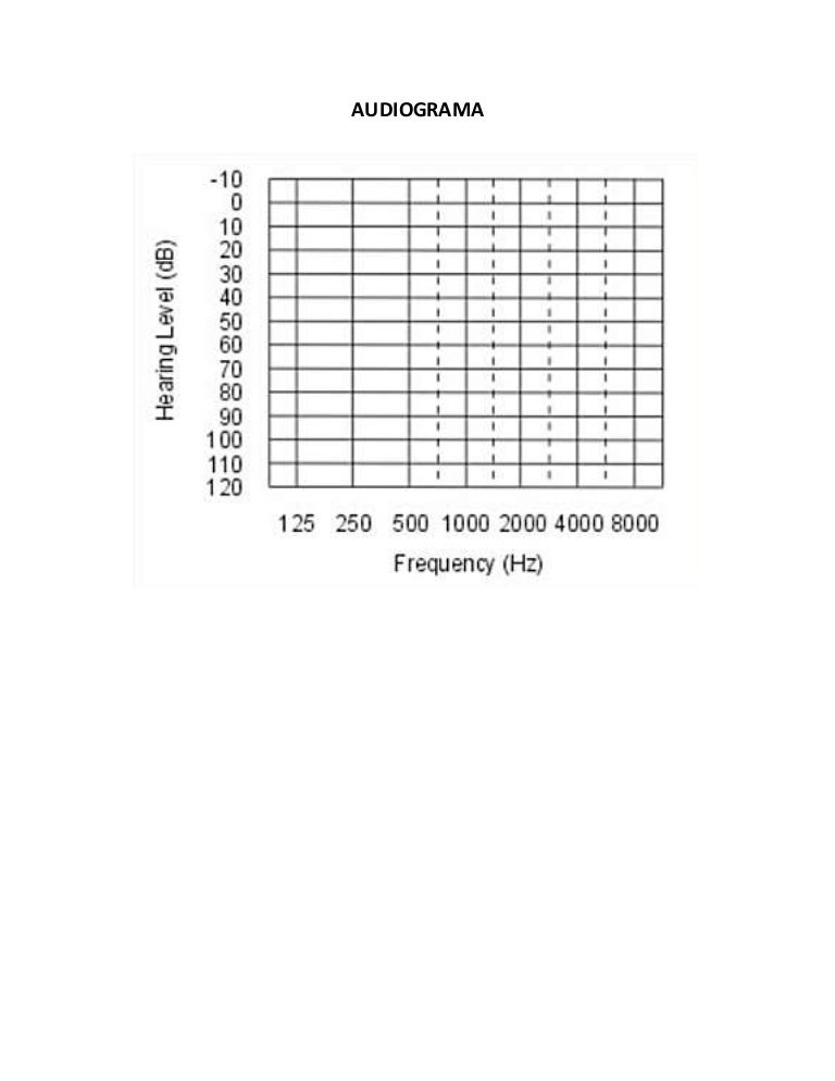 Audiograma