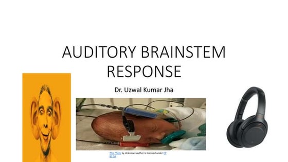 Auditory brainstem response (ABR) | PPT