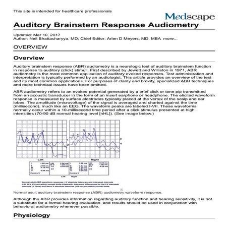 Auditory brainstem response audiometry overview, physiology ...