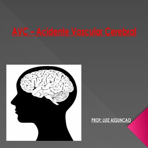 Slide sobre AVC Acidente Vascular Cerebral.pptx