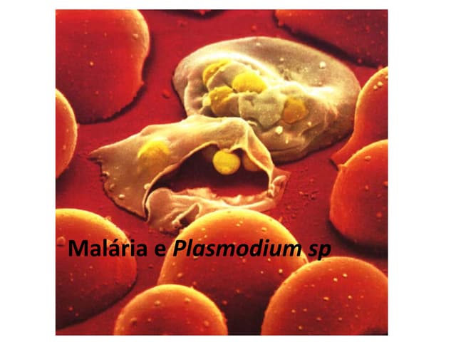 Aula 4 Malaria E Plassmodium Ppt