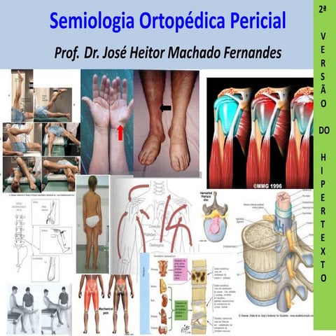 Aula de anatomia ossea e lesoes slides 285 pg | PPT