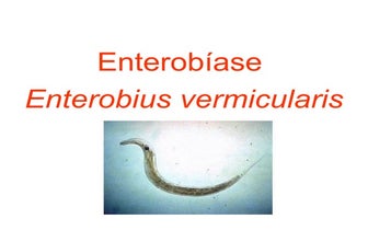 Enterobius Vermicularis Slide