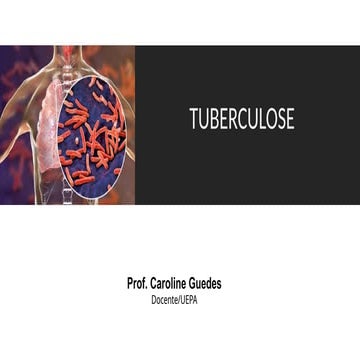Tuberculose | PPTX