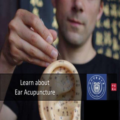 Auricular Acupuncture | PPTX