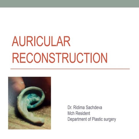 Auricular reconstruction | PPTX
