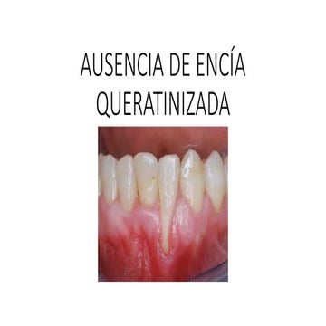 AUSENCIA DE ENCÍA QUERATINIZADA.pptx