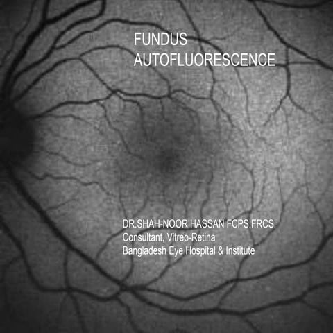 Autofluorescence | PPTX