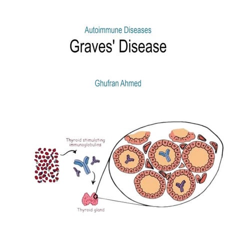 Autoimmune Diseases "Graves' Disease" | PPTX