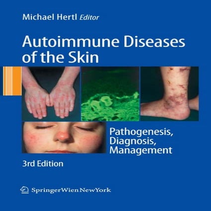 Autoimmune Diseases of the Skin_ Pathogenesis, Diagnosis, Management ...