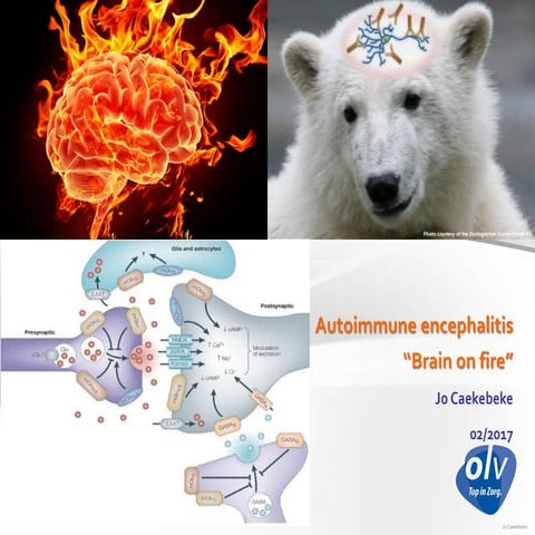 Autoimmune encephalitis - Dr. J. Caekebeke | PPT