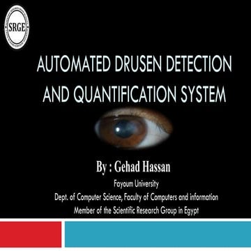 Automated Drusen Detection And Quantificatioon System Pdf Eye And