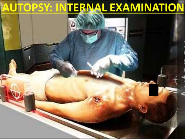 Presentation autopsy incisions-.pptx. Dr. Haricharan MD RIMS Imphal . MBBS- IGMC&RI PONDICHERRY ...