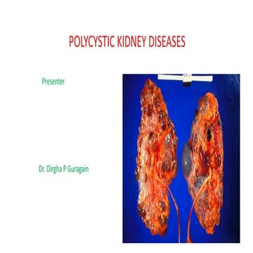 Autosomal Dominant Polycystic Kidney Disease (ADPKD).pptx