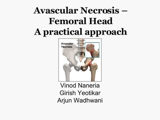 Avascular Necrosis Of Hip Joint Ppt
