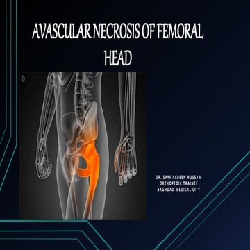 Avascular Necrosis (AVN) | PPTX