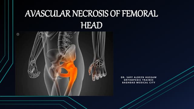 press operation | PPTX