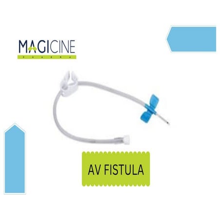 AV FISTULA.pdf