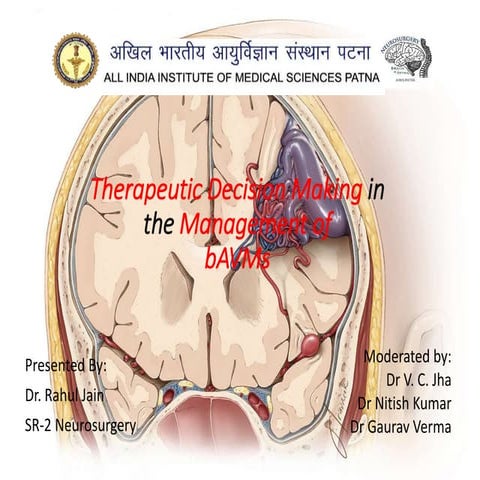 Brain AVM (ArterioVenous Malformation) Managment.pptx